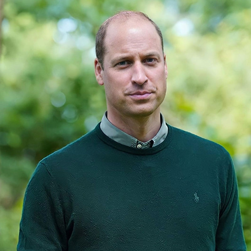 Best Hairstyles For Balding Men To Reignite Your Confidence